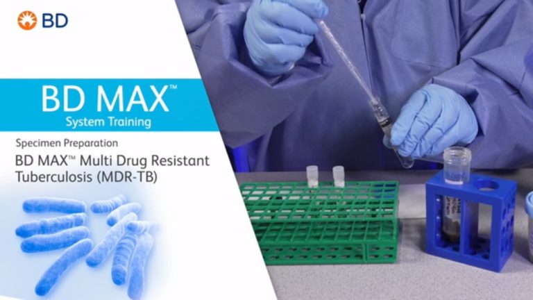 BD MAX™ System - In-service video - BD MAX™ Club