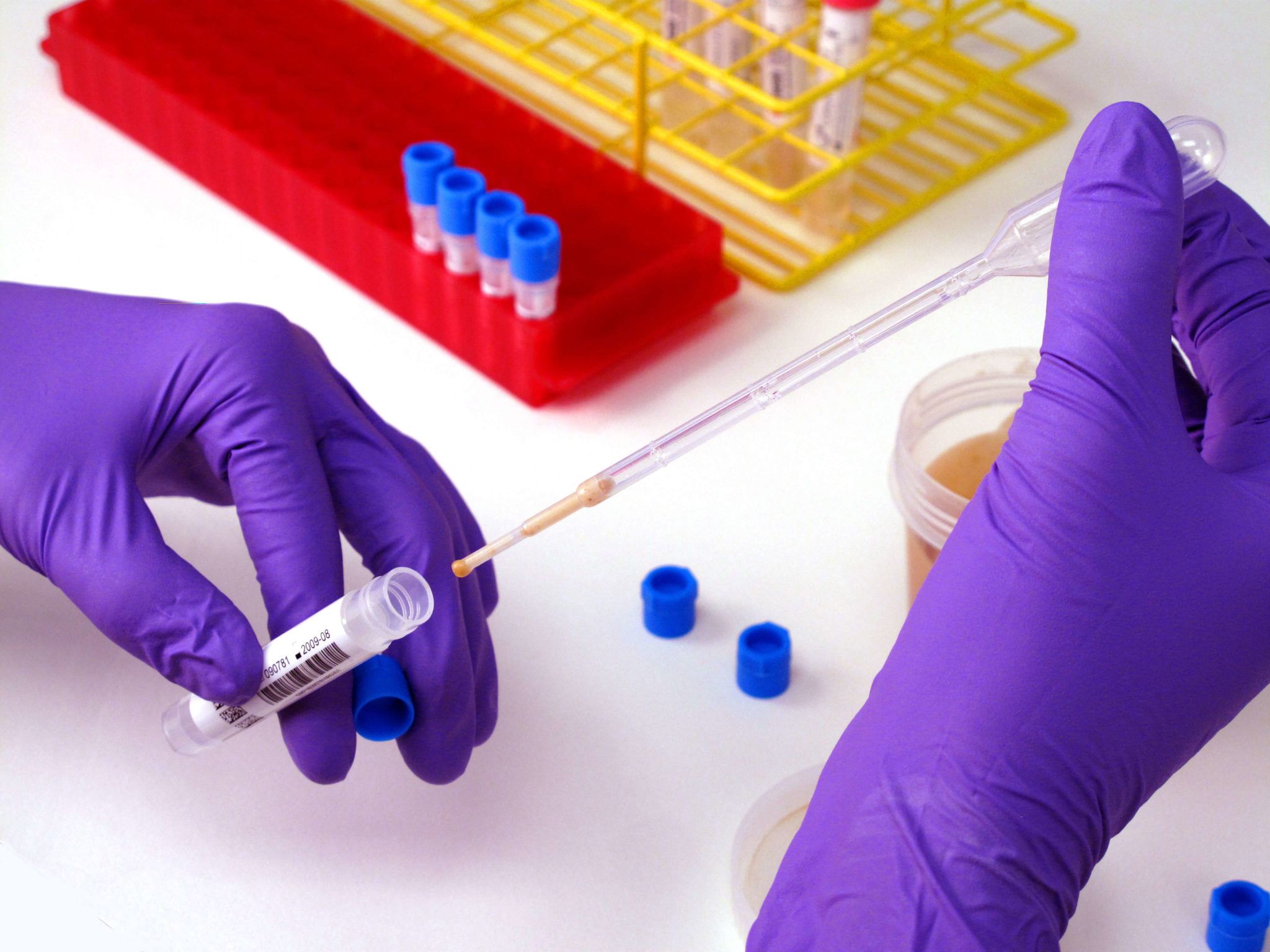 Staff picks: Our 3 favourite BD MAX™ Club pages to explore - BD MAX™ Club